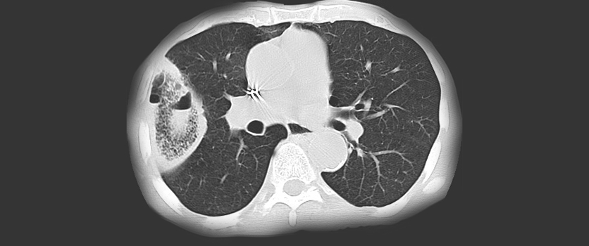 Divisions: Department of Radiology: Feinberg School of Medicine ...