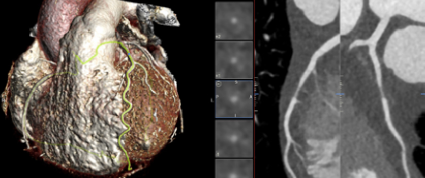 Divisions: Department of Radiology: Feinberg School of Medicine ...